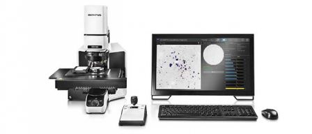 Metal Contamination Analysis of Automotive Lithium-Ion Batteries using ...