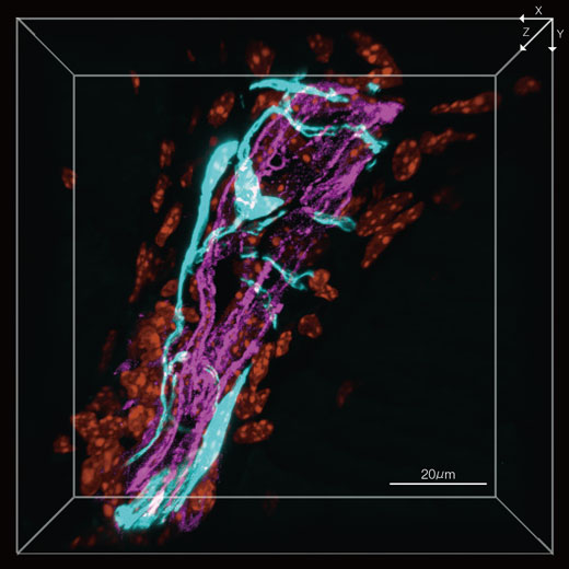 Discovering Fine Neurovascular Structures in Tibial Epiphysis Using the ...