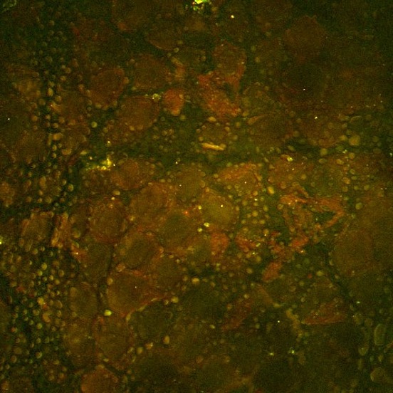 Making the Invisible Visible to Improve Patient Outcomes: A ...