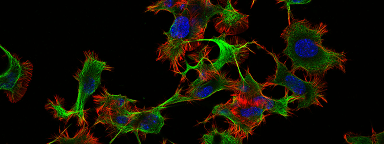 6 Tips for Fluorescence Live Cell Imaging | Olympus LS