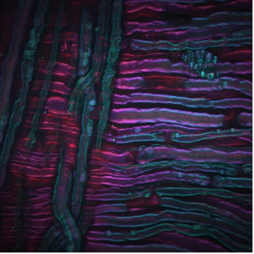 Making the Invisible Visible to Improve Patient Outcomes: A ...