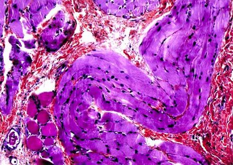 Sycamore Tree (Plantanus occidentalis) Section