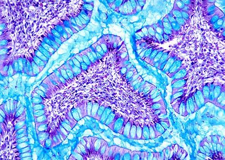 Digestive Tissue Goblet Cells