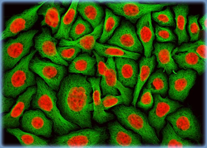 Human Cervical Adenocarcinoma Cells (HeLa Line)