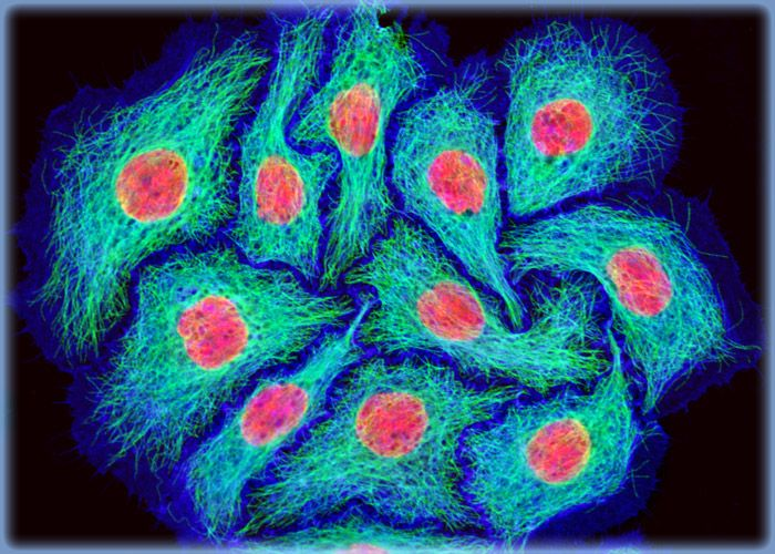 HeLa Cervical Carcinoma Cells Labeled with Alexa Fluor Dyes and TO-PRO-3