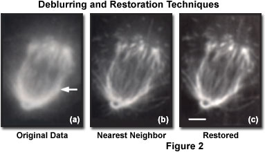 Algorithms for Deconvolution Microscopy