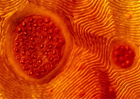 Rocky Mountain Wood Tick | Evident Scientific