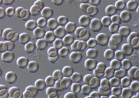 Human Blood Cells Under A Microscope
