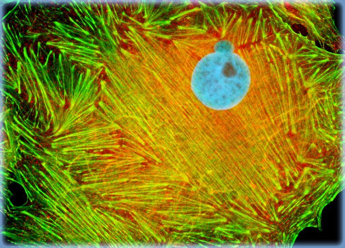 Normal African Green Monkey Kidney Epithelial Cells (Vero)