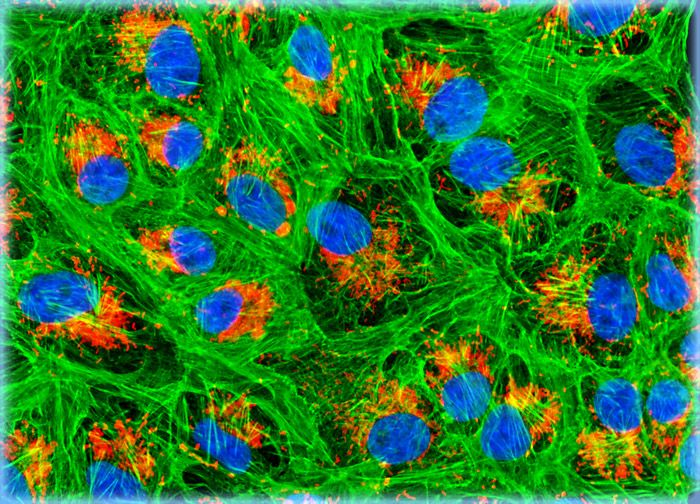Normal African Green Monkey Kidney Epithelial Cells (Vero)