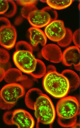 Pine Tree Pollen | Evident Scientific