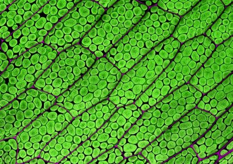 C’est facile d’être vert : nos images de microscopie les plus ...