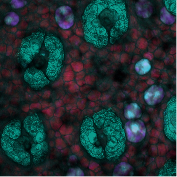 見えないものを視覚化して患者の予後改善に貢献したい：Conor Evans博士へのインタビュー | オリンパス ライフサイエンス