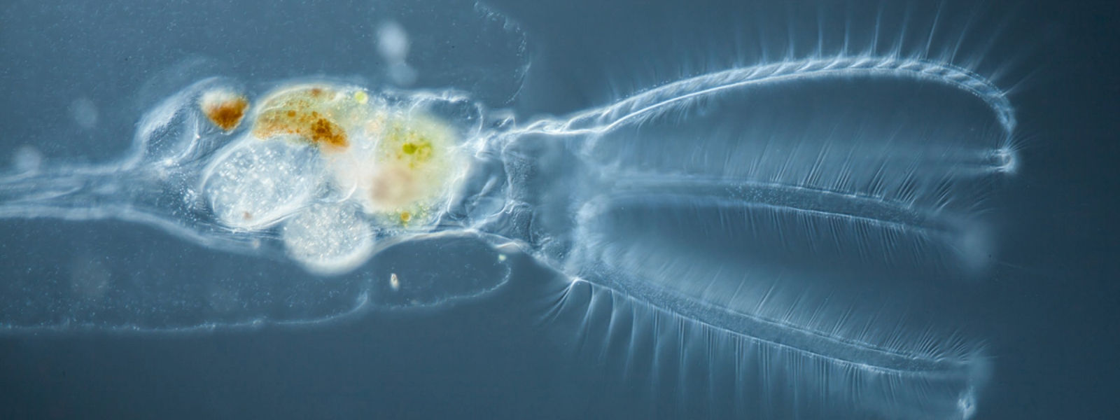 Avalonさんは、ワムシを研究するための夢のような顕微鏡に出会いました | オリンパス ライフサイエンス