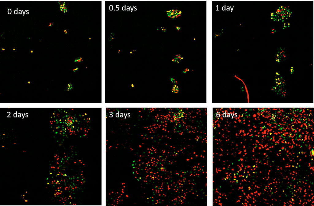 使用 scanR 系统的 TruAI™ 深度学习技术监控干细胞分化过程中的细胞周期动力学 | Olympus LS